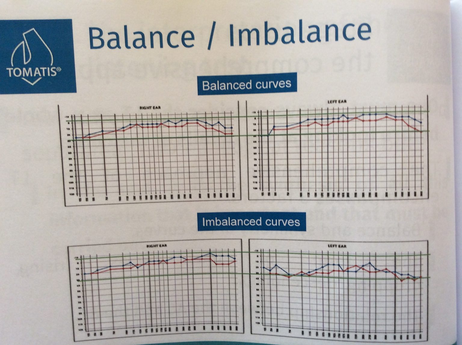 Tomatis® Audio-Vocal Training - TheSingersCENTER
